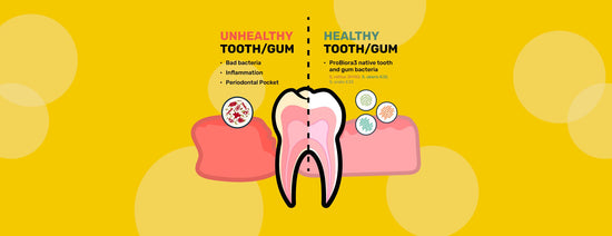 Why Strains Matter - Choosing An Oral Care Probiotic – ProBiora Health